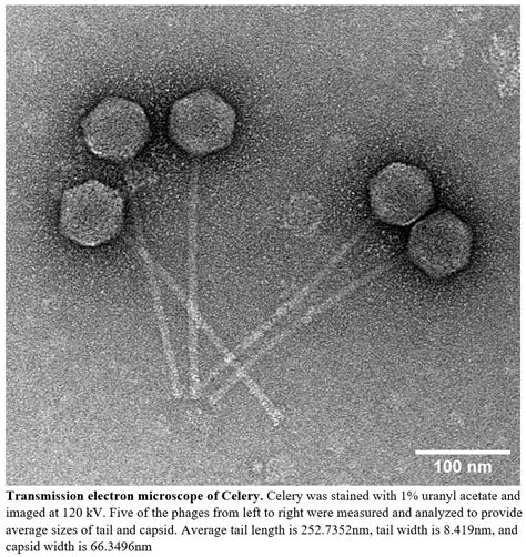The Actinobacteriophage Database Phage Celery