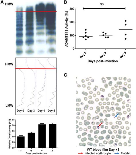 Severe P Berghei Malaria Influences Plasma Vwf Multimer Composition Download Scientific