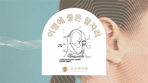 돌발성난청 청각과민증 이명에 좋은 혈자리 아차산역보인한의원 네이버 블로그