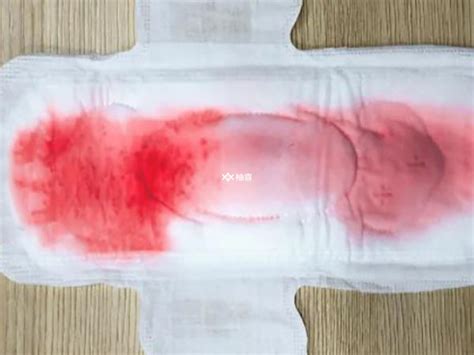 10 20毫升的月经量示意图片分享血到卫生巾上有多少看完便知 柚喜学园