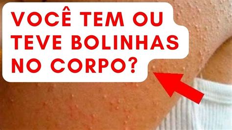 YouTube Bolinhas