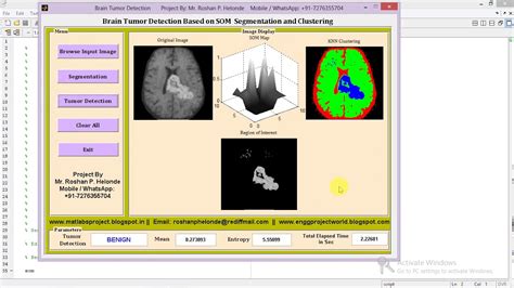 Brain Tumor Detection Using Segmentation And Clustering Image Processing Matlab Project Code