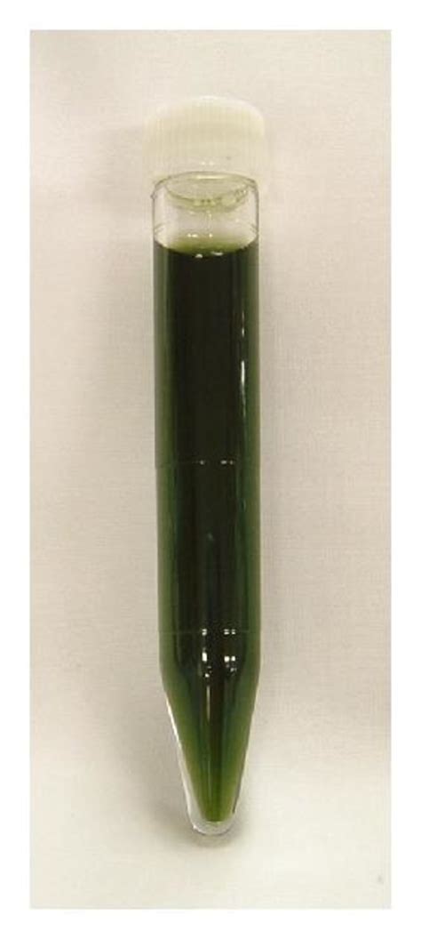 The Urine Became Green After Propofol Infusion Download Scientific