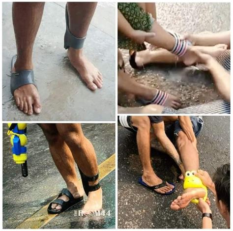 Korat Next Step เตือนภัย รองเท้ากินขา