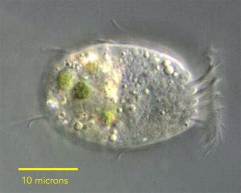一种专吃病毒的浮游生物，美大学公布重大发现 星岛环球网