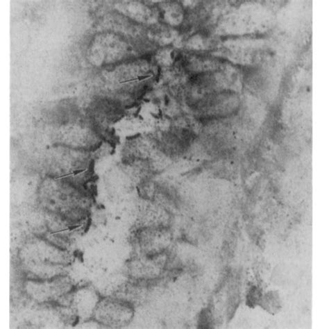 Detection Of Helicobacter Pylori In The Antrum Biopsy Specimen By In Download Scientific