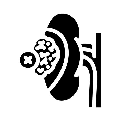 Nephrectomy Surgery Glyph Icon Illustration 49842992 Vector Art At Vecteezy
