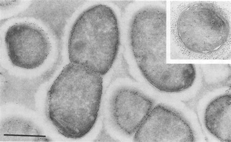 Streptococcus Salivarius Morphology