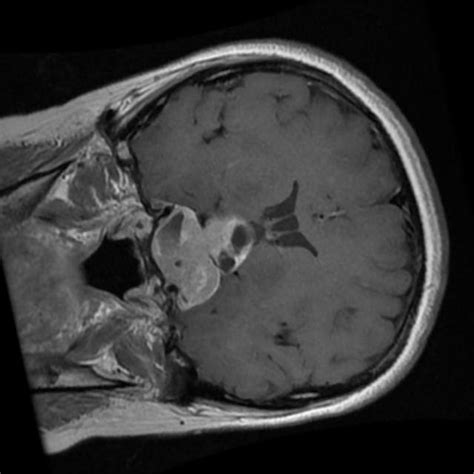 Final Tumor Classification Classification Dataset By College