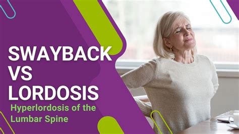 Swayback Vs Lordosis Hyperlordosis Of The Lumbar Spine Youtube
