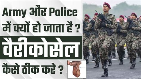 Army और Police में क्यों हो जाता है वैरीकोसेल कैसे ठीक करे How To