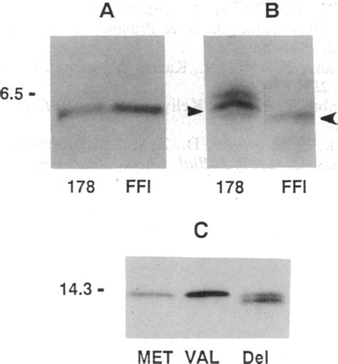 Comparison Of Carboxyl And Amino Terminal Fragments From Cjd178 Lane