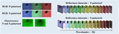SkinSpect Data Output Includes RGB Fluorescence And Hyperspectral