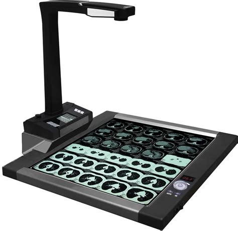 Joyusing Ct160 X Ray Film Scanner For Hospital And Clinic Diagnosis