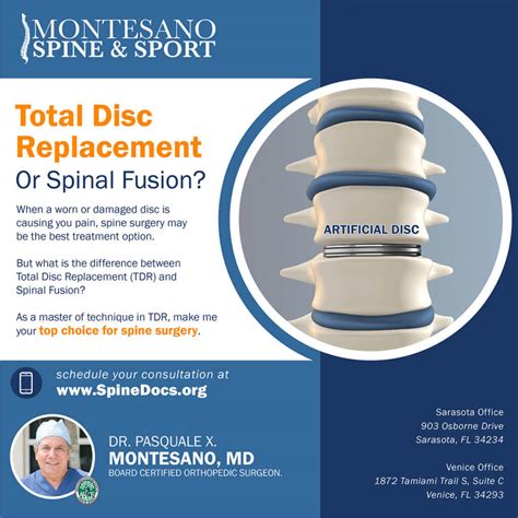 Total Disc Replacement Or Spinal Fusion Spine Docs