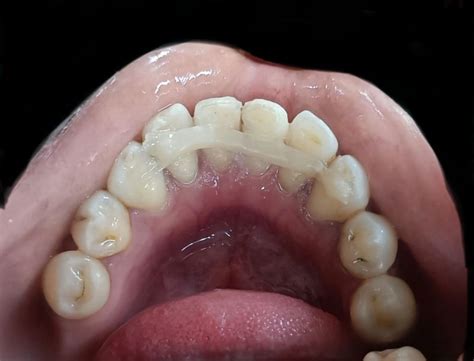 Deepthika Balakrishnan On Linkedin Interlig Magic 🪄