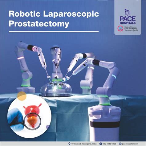 Green Light Laser Prostate Surgery Cost Australia Shelly Lighting