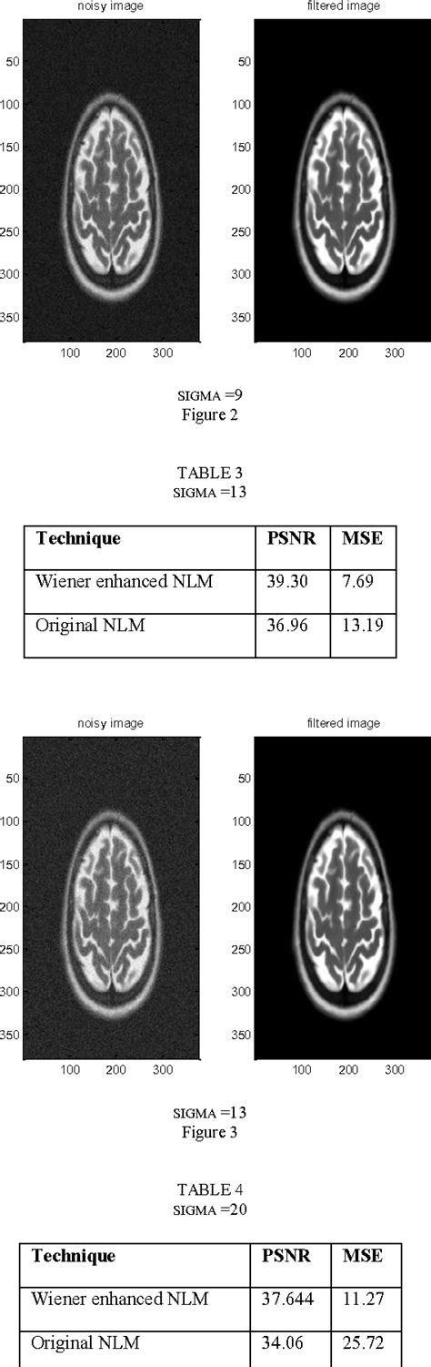 Table 4 From An Improved Approach For Denoising Mri Using Non Local