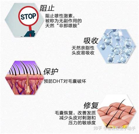 男性脱发后去植发了那么头发还会脱落吗？ 知乎