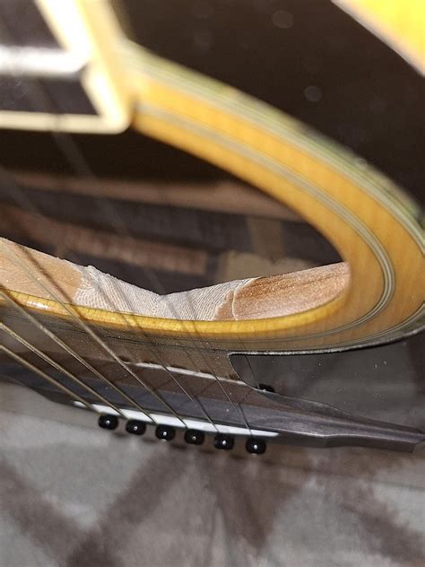 X Brancing Bandage R Acousticguitar
