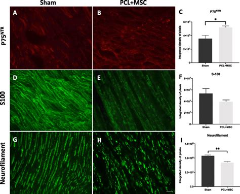 Fluorescence Intensity Analysis Of P75NTR S100 And Neurofilament On