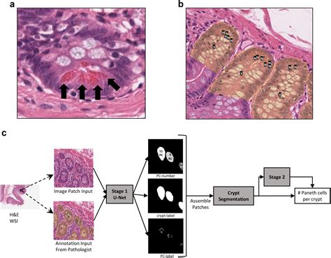 Paneth Notum Produced By Paneth Cells Attenuates Regeneration Of Aged
