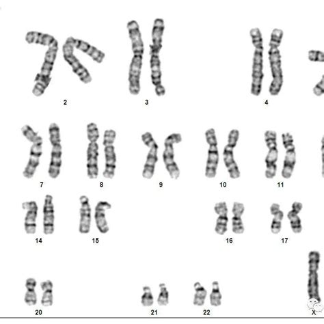 Chip Seq，merip Seq峰（peak），eccdna等基因组位置染色体分布可视化 数据 示例 Chr