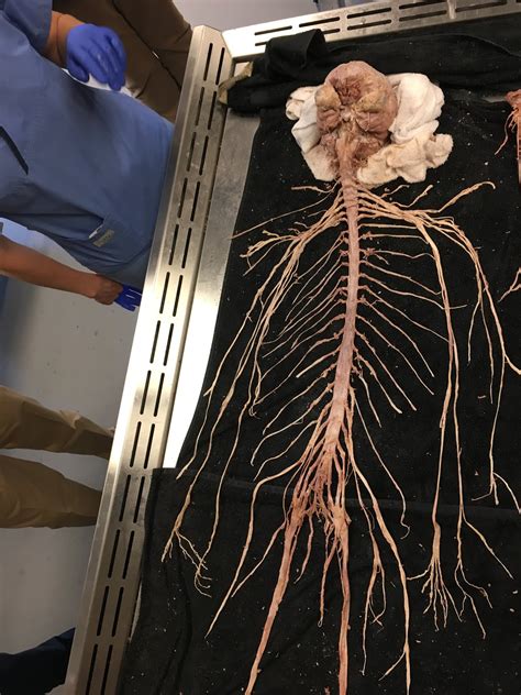 Human Nerves