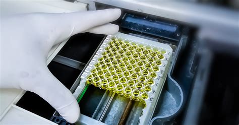 Selecting The Right Method Or Test Kit For Your Food Allergen Testing