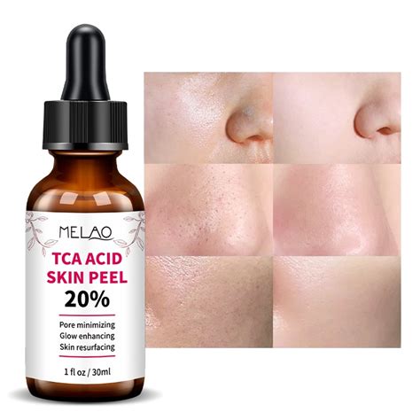 MELAO TCA Acid Skin Peel 20 Serum Whitening Anti Aging Pore Minimizing