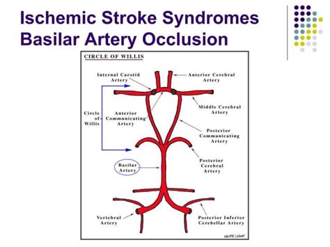 3alapproach To Cva In The Emergency Department Ppt