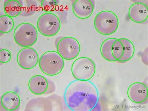 【细胞识别】yolov8实现cbc细胞检测血球cbc 模式检测 Csdn博客