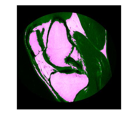 use freehand rois to refine segmentation masks matlab and simulink