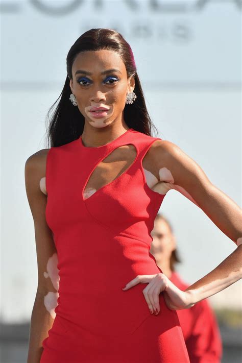 Winnie Harlow Latest Photos Celebmafia
