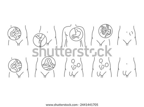 Hernias Line Icons Set Vector Isolated Stock Vector Royalty Free 2441441705 Shutterstock