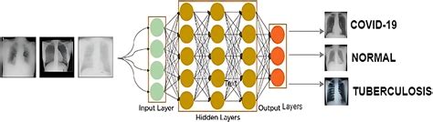 Energy Efficient Model “densenet201 Based On Deep Convolutional Neural