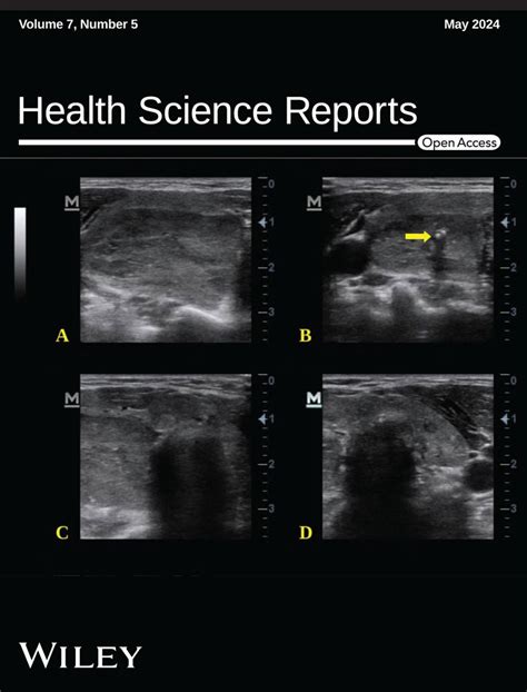 Health Science Reports Vol 7 No 5