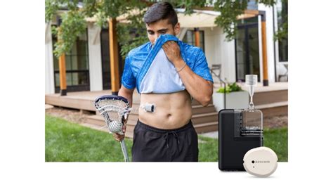 Tandem Mobi Automated Insulin Pump Now Pairs With Dexcom G7 Cgm Medical Product Outsourcing