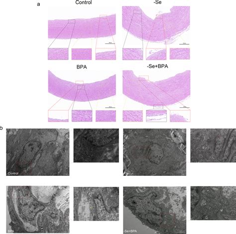 Effects Of Bisphenol A Exposure And Selenium Deficiency On Pathological
