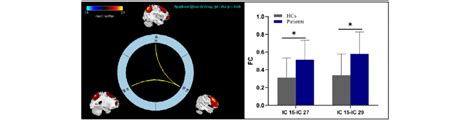 Results Of Functional Connectivity Among Independent Components Of ECN Download Scientific