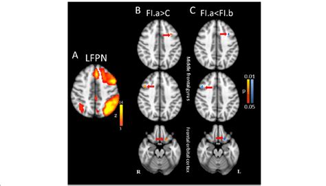 A Left Fronto Parietal Network Lfpn As Revealed By Ica B Between Download Scientific Diagram