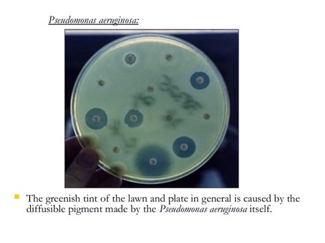 6 Laboratory Diagnosis Of Bacterial Infection