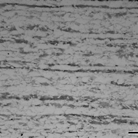 Optical Micrograph Of The Hot Rolled Microstructure Following Coiling
