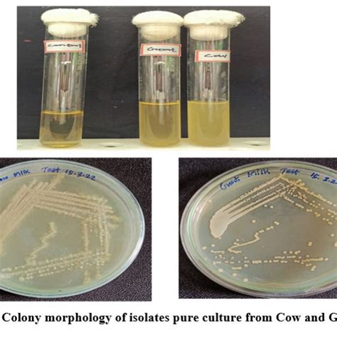 Antibacterial And Anti Diabetic Activities Of Ethyl Acetate Fractions Of Lactobacillus Isolated