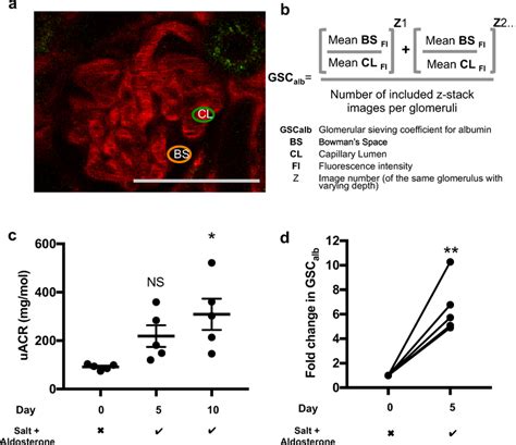 Aldosterone Induces Albuminuria Via Matrix Metalloproteinase Dependent