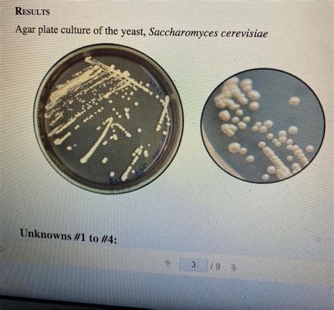 Solved 5 How Does The Agar Plate Culture Of S Cerevisiae