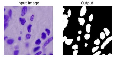 Github Prabhatk579unet Based Image Segmentation Of Nuclei From