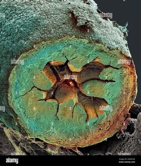 Small Intestine Coloured Scanning Electron Micrograph Sem Of A Cross Section Through A Foetal