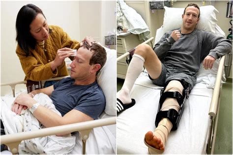 Meta Chief Mark Zuckerberg Undergoes Surgery To Fix Torn Acl The