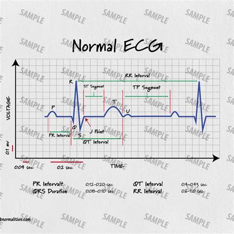 Ekg Basics Digital Download Letter Sized Etsy Canada Mémorisation Nclex Cartes Imprimables